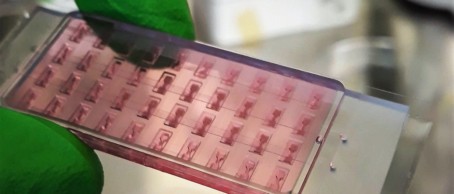 Organ-on-chip tests COVID-19 cardiac damage