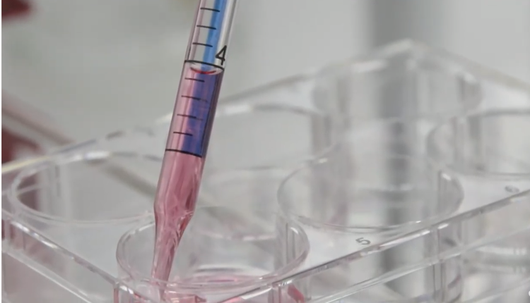 Heart-on-chip: improved treatment of cardiac arrhythmia