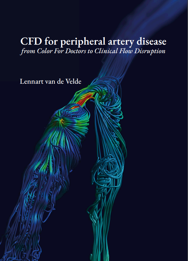 PhD Defence Lennart van de Velde | CFD for peripheral artery disease ...